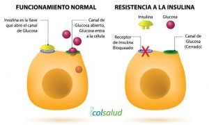 Resistencia a la Insulina | Aprende como Altera tu Metabolismo | Colsalud
